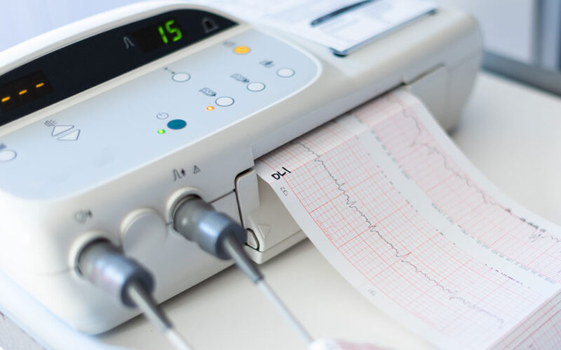 Medical Imaging Services in South Harrow | X-Ray, Ultrasound & MRI Scans