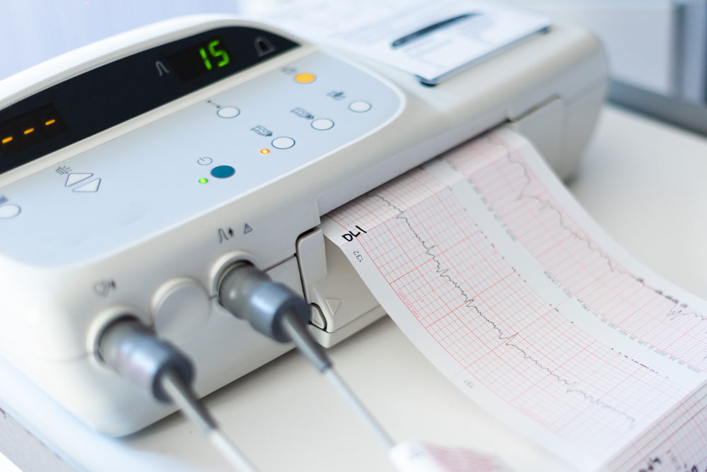 Effortless ECG Exam: Understand Your Heart's Health