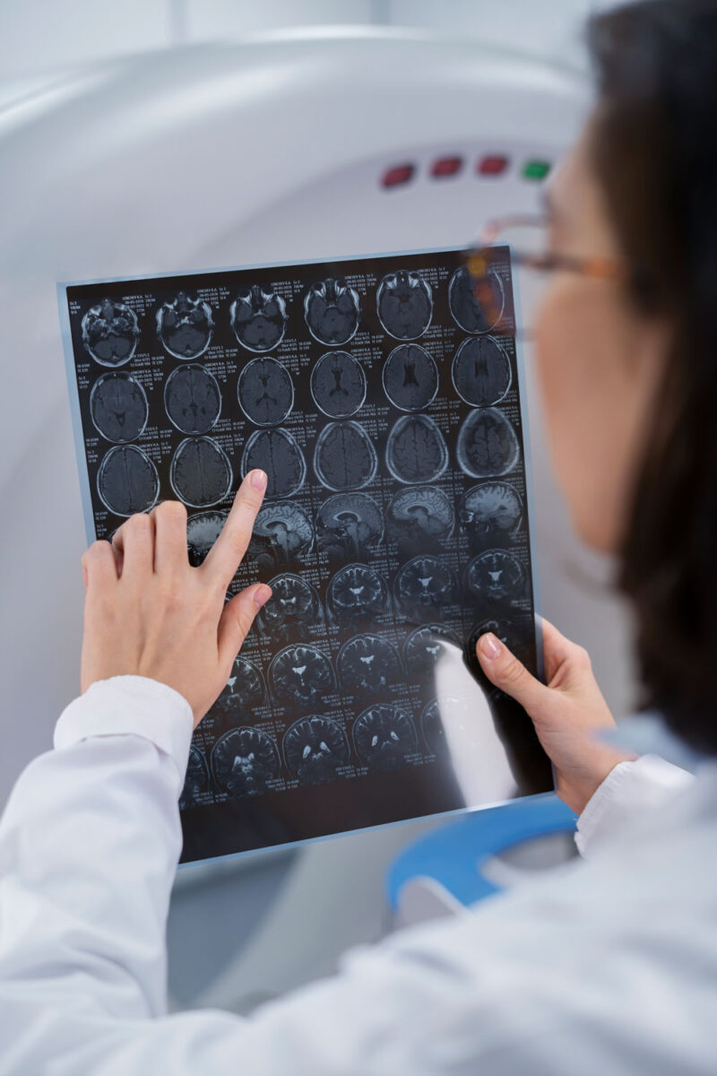 Comprehensive MRI Scans at Skyline Medical Clinic